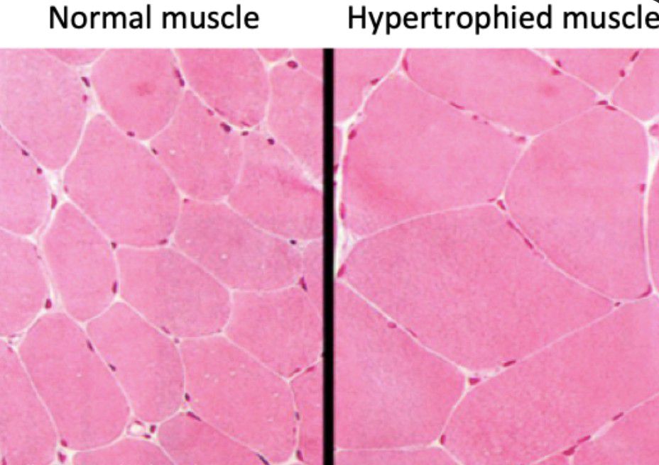 Hypertrophy – joyancejames